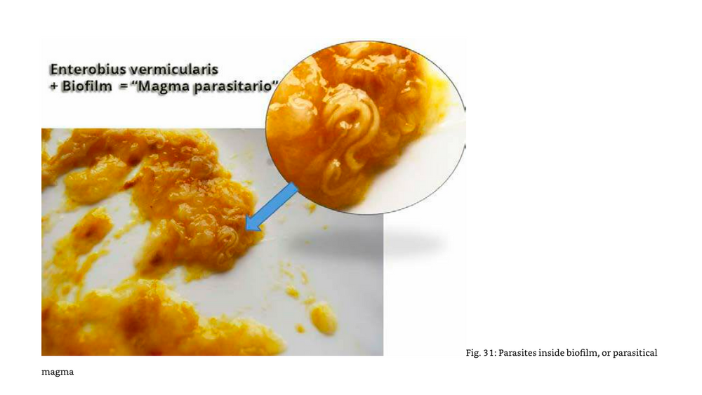 How To Do The Parasite Protocol (Revised & Updated)