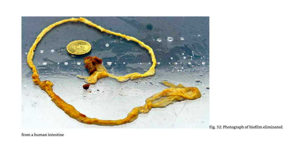 How To Do The Parasite Protocol (Revised & Updated)