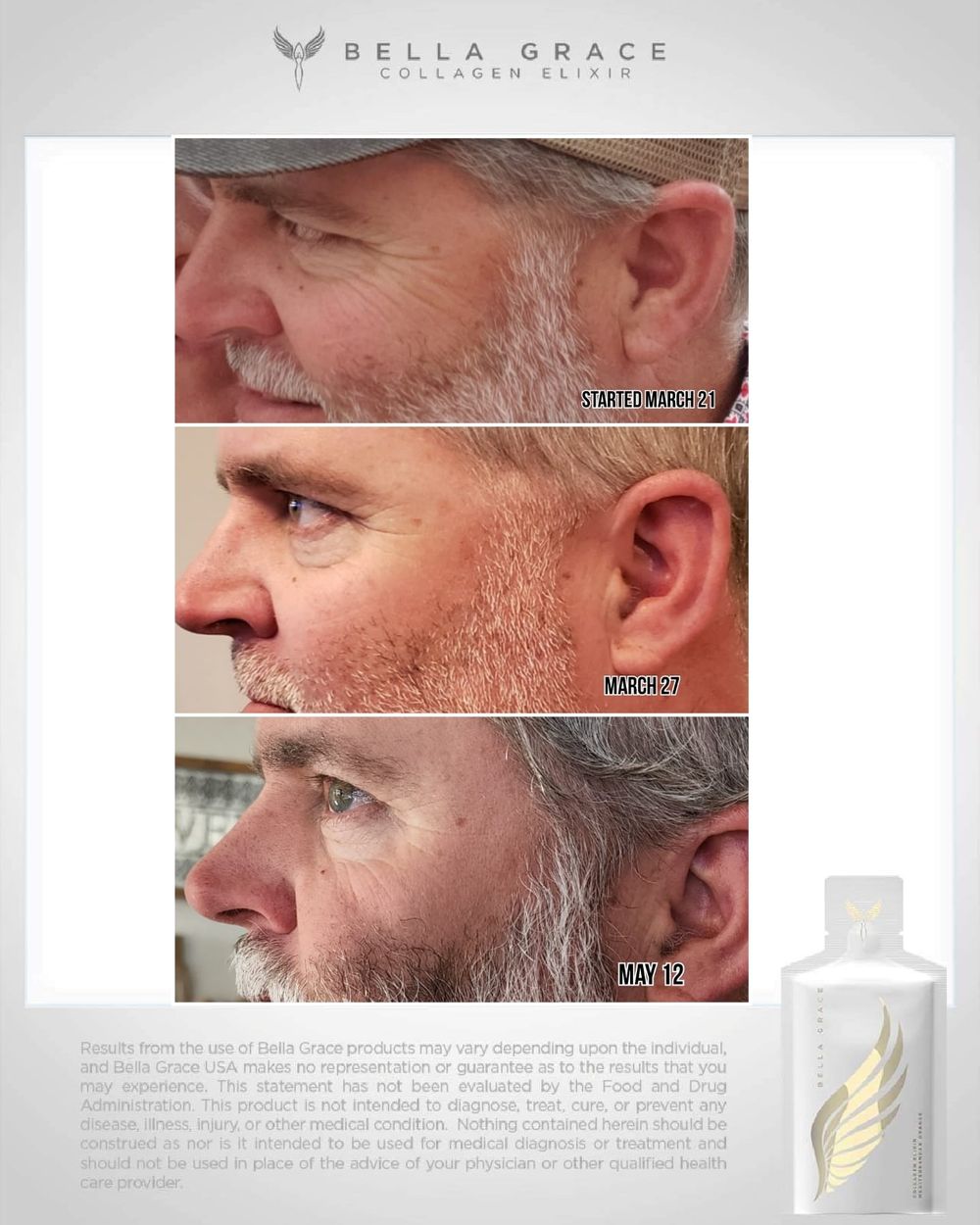 Bella Grace Collagen Elixir: Before & After Photos