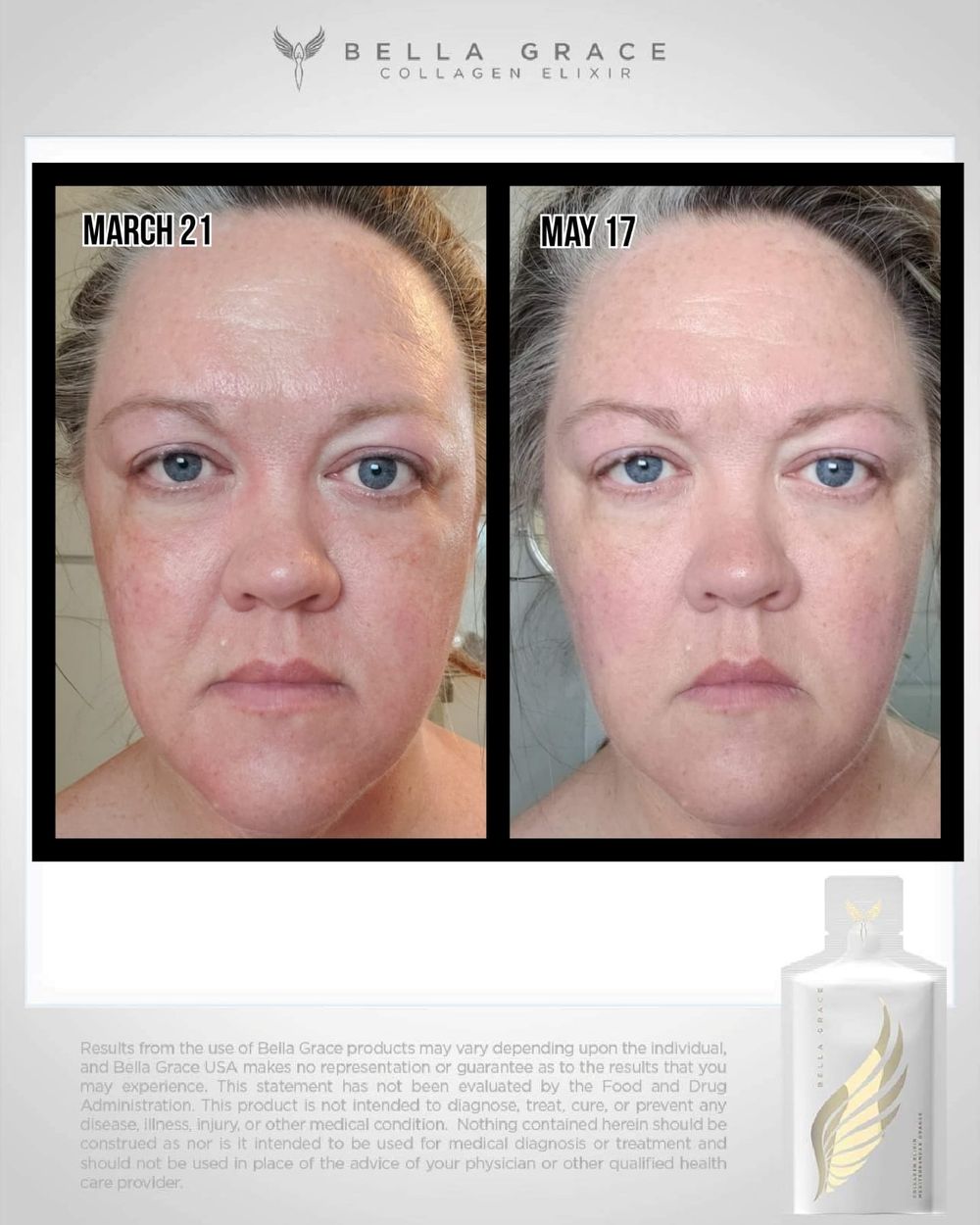 Bella Grace Collagen Elixir: Before & After Photos