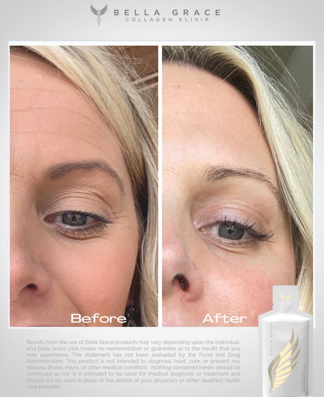 Bella Grace Collagen Elixir: Before & After Photos